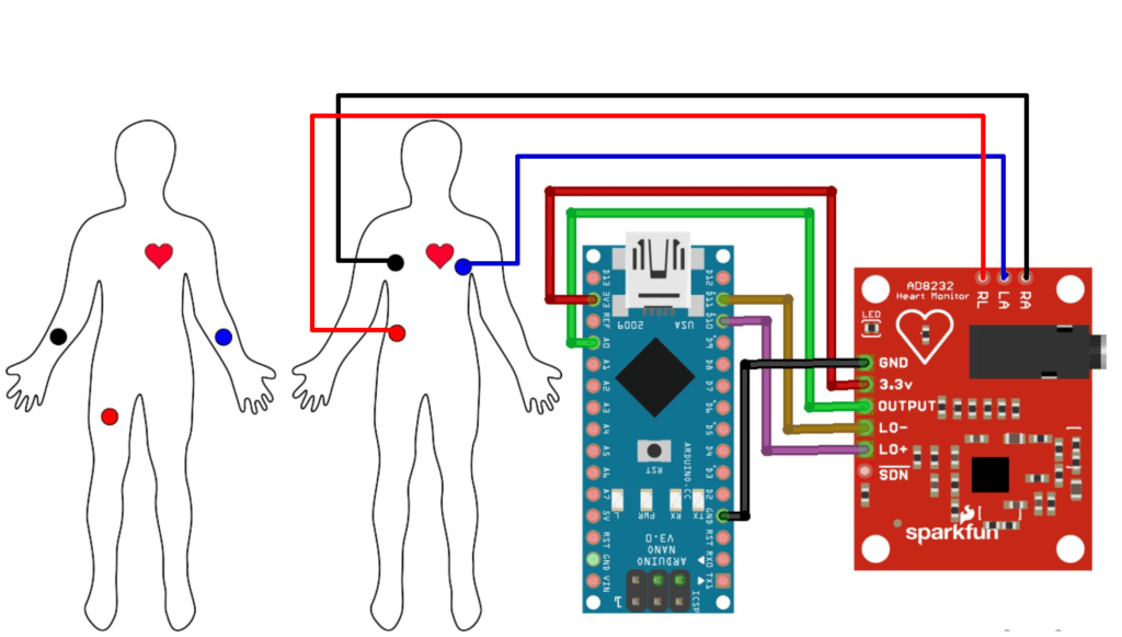 Real-Time ECG Monitoring with AD8232 & Arduino | Health Track